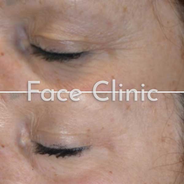 Personalised Skincare Plan from Face Clinic
